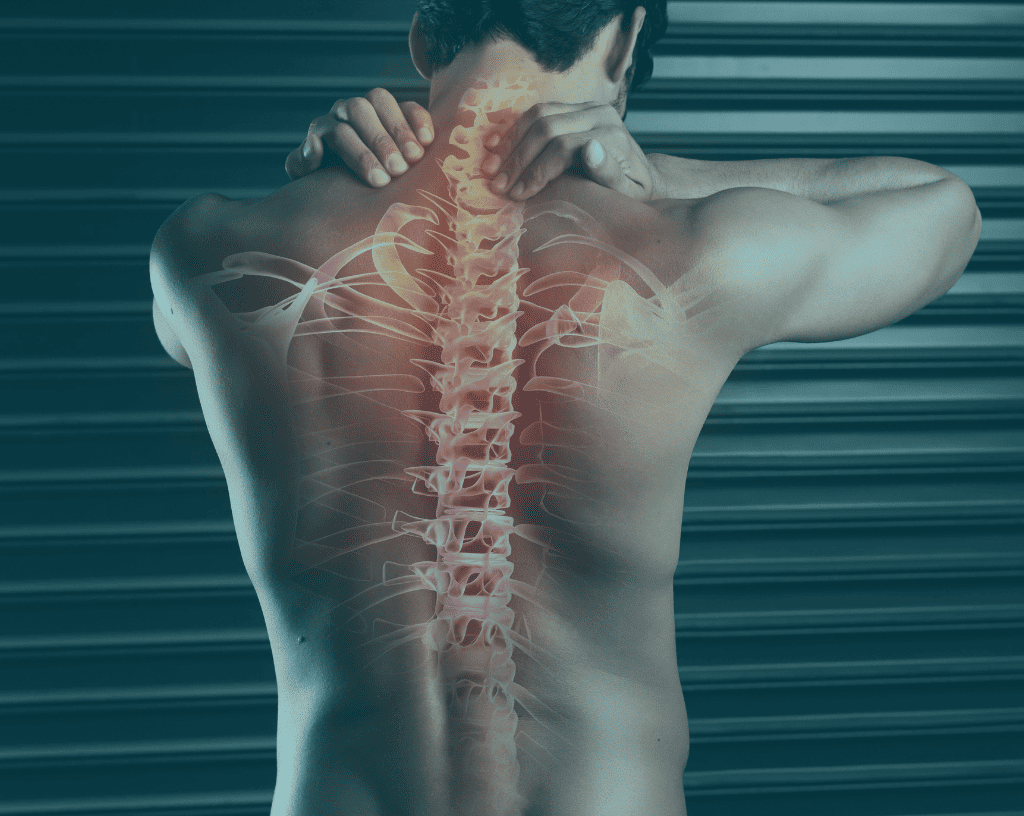 Medical Record Review for Epidural Steroid Injury Case